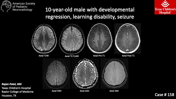 10-year-old male with developmental regression, learning disability ...